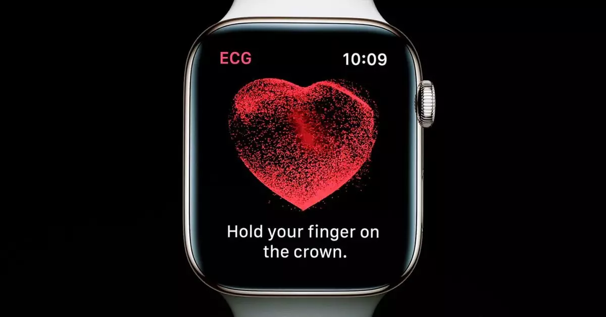 Fa'afefea ona ave se ECG (electrocardiogram) ile Apple Watch [Gallery]