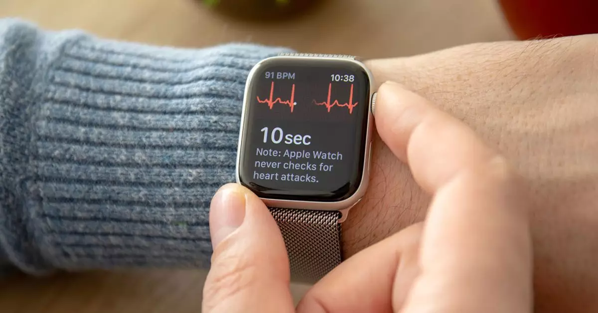 Apple Watch obtén a aprobación da FDA para a nova función de historial de Afib