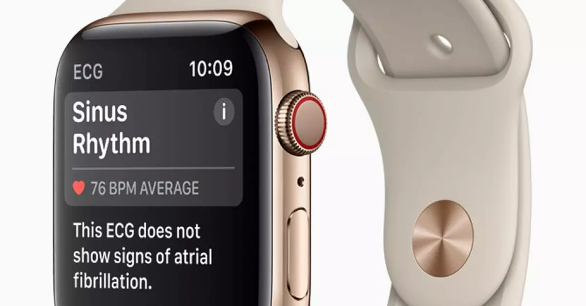 I-Apple Watch Series 4 ngaphezulu kwe-98% echanekileyo ekufumaneni i-AFib, ifumana isifundo