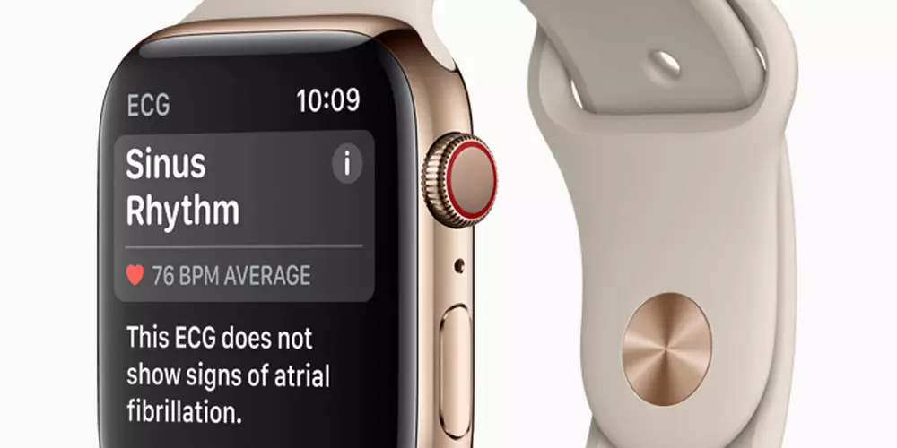 Apple Watch Series 4 tem mais de 98% de precisão na detecção de AFib, segundo estudo 1133_1