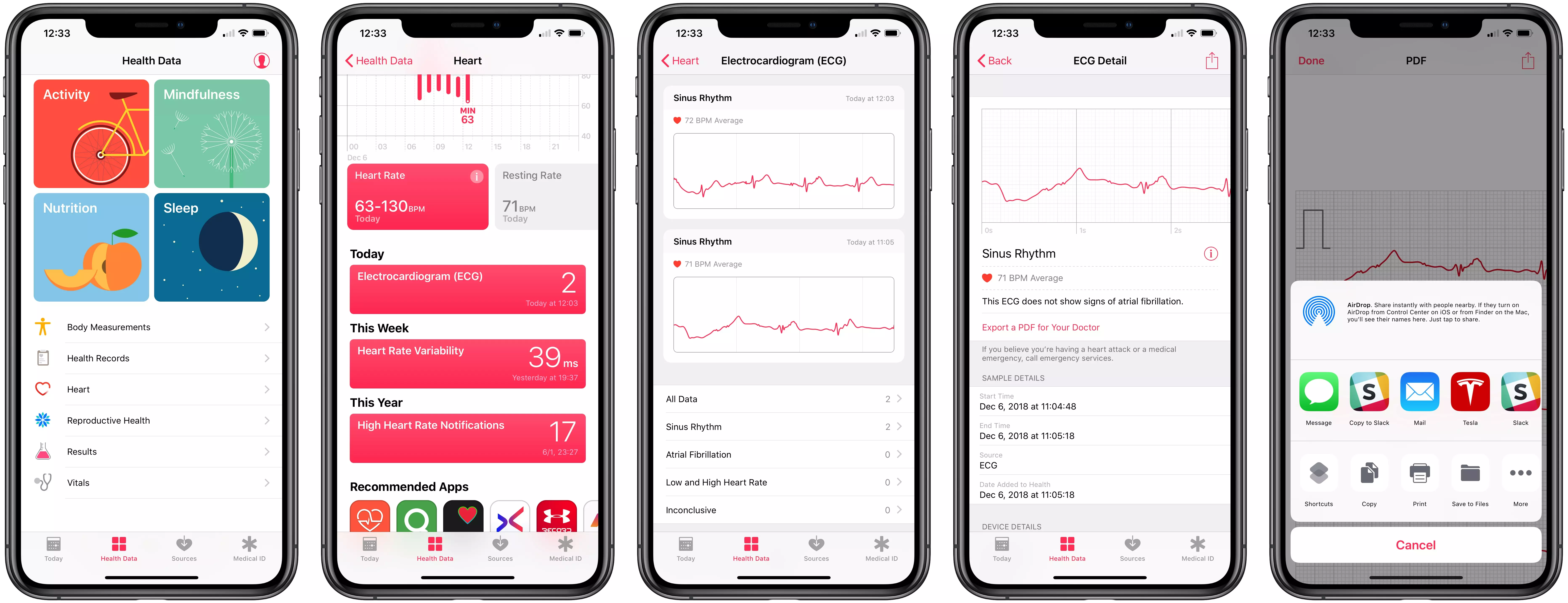 Meriv çawa encamên ECG bi doktorê xwe re parve dike 1143_2