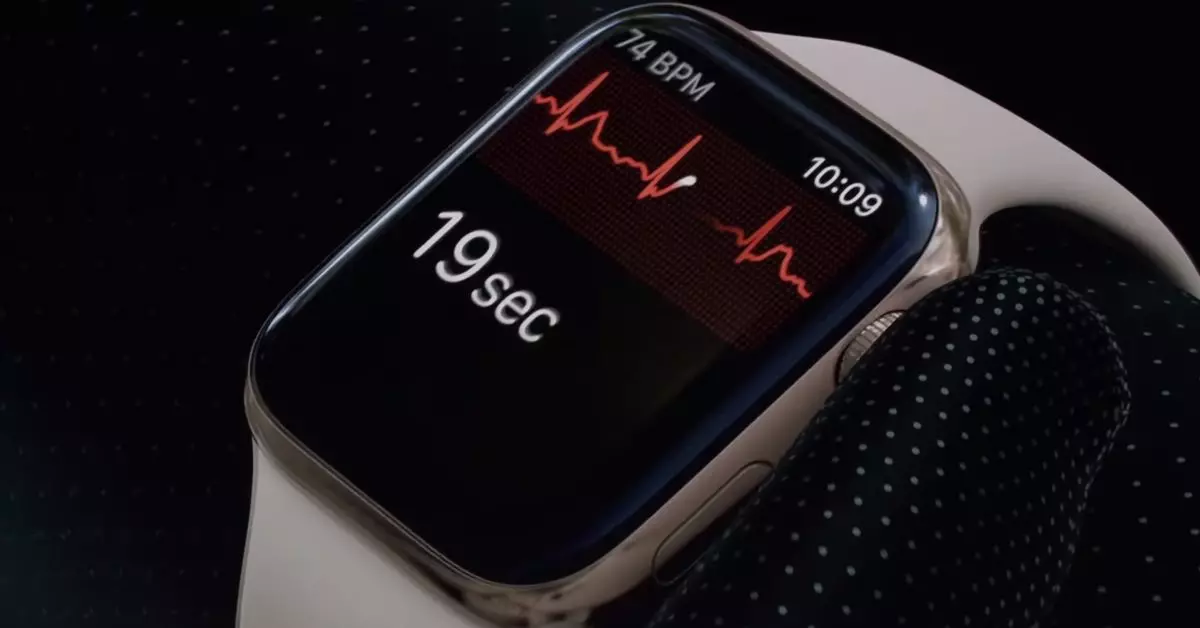 Apple Watch Client identifizéiert A-fib Häerzkonditioun nodeems se Symptomer als "Vakanzangst" entlooss hunn