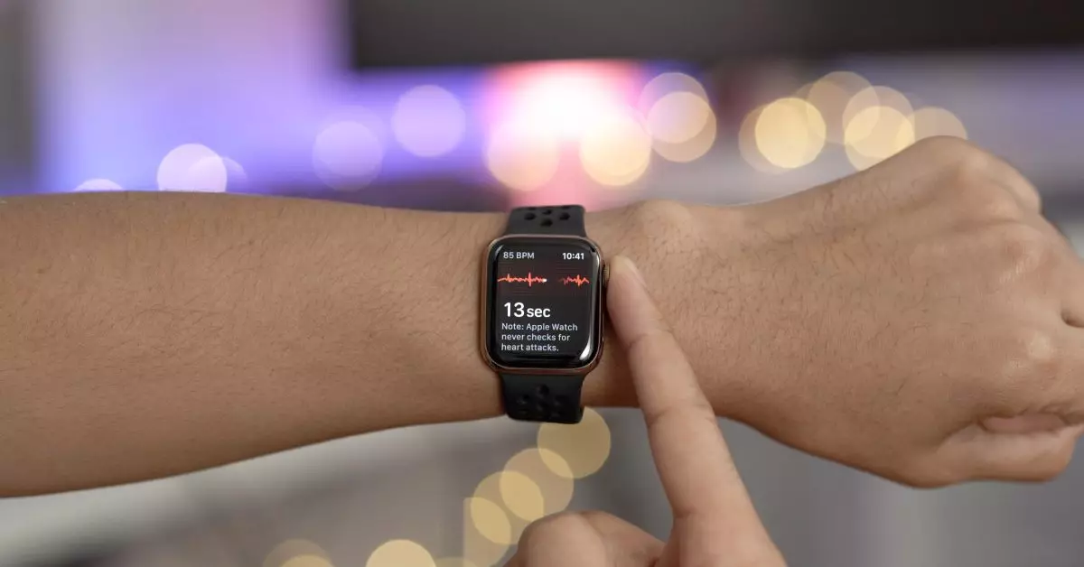 Apple Watch ECG kredite ak anpeche konjesyon serebral yon itilizatè a