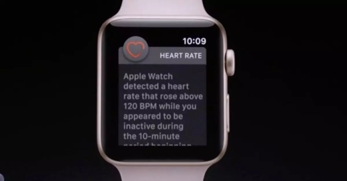 Itilizatè Reddit di ke Apple Watch te sove lavi l 'ede detekte takikardya supraventricular